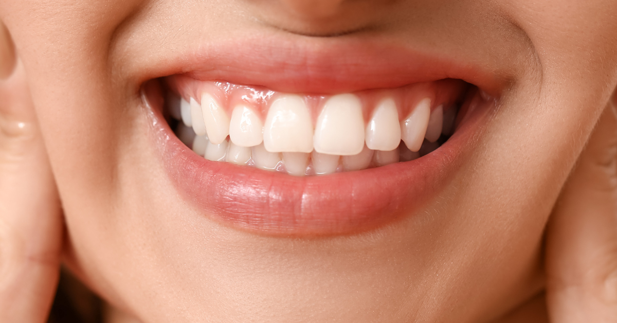 Ayurvedic Dental Care: Strengthening Gums and Teeth Naturally with ayurveda