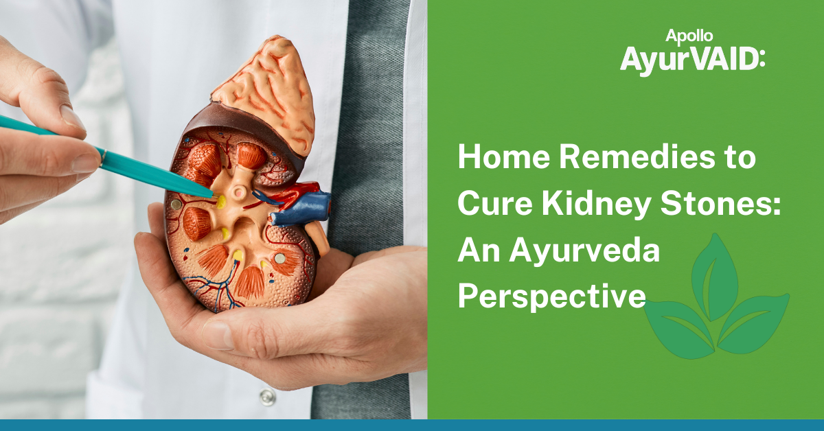 Home Remedies to Cure Kidney Stones Causes Remedies and Prevention